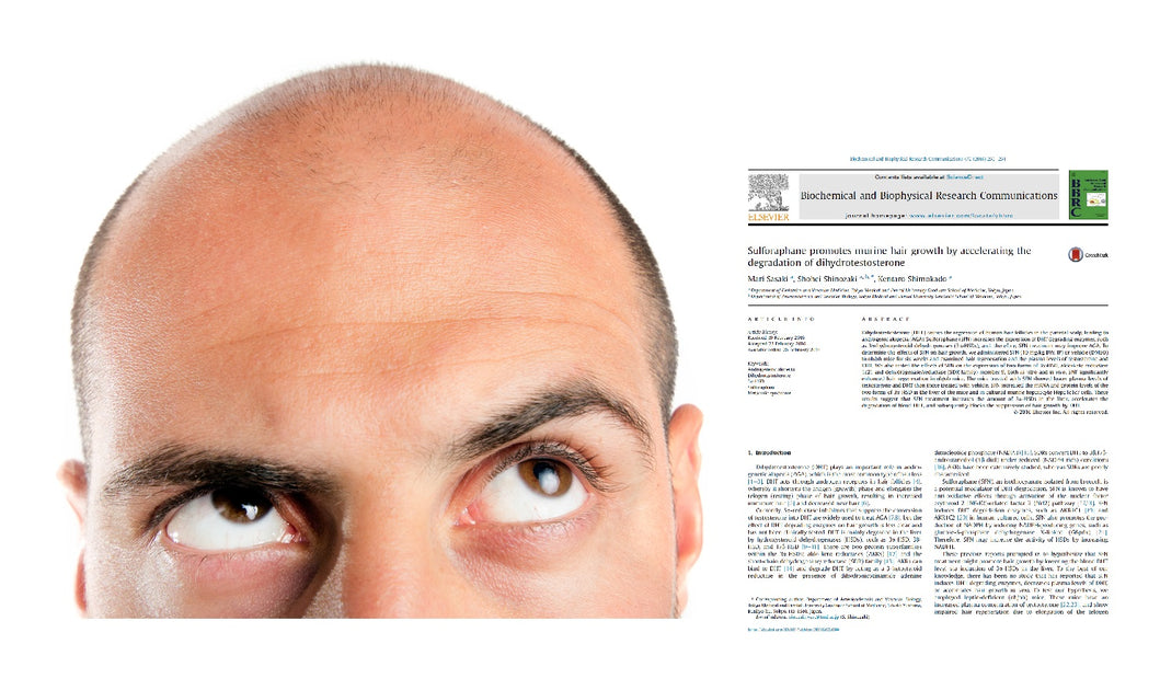 Review: Sulforaphane Helps With Balding – BrocElite